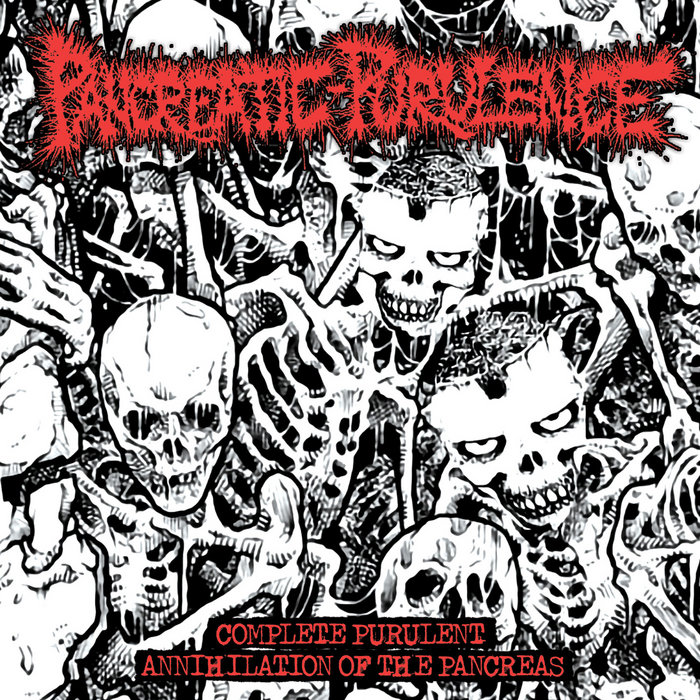 Complete Purulent Annihilation Of The Pancreas | PANCREATIC PURULENCE ...