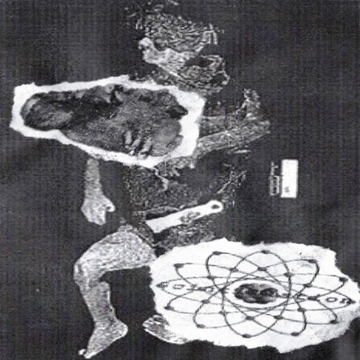 Congenital Malformation With Internal Bodily Decay From Severe ...