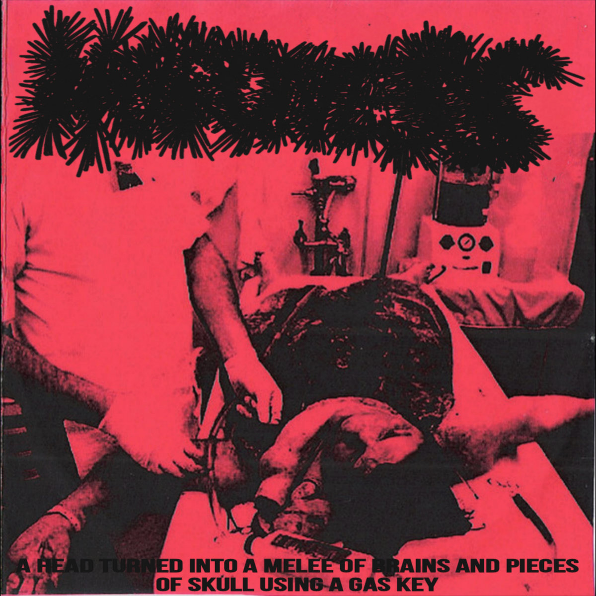 A Head Turned Into A Melee Of Brains And Pieces Of Skull Using A Gas ...