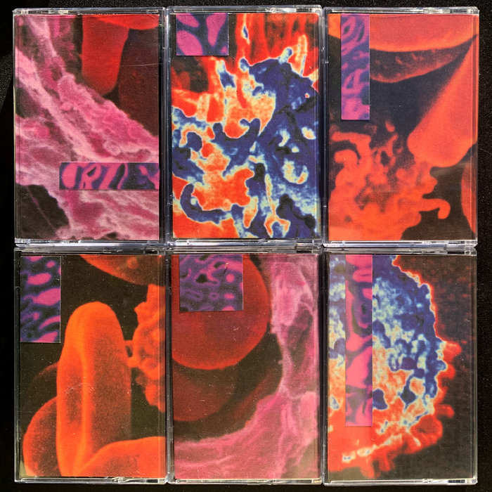 VALVE | OUTLIERS | OCOMM