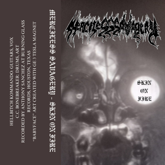 SKIN ON FIRE | Merciless Savagery