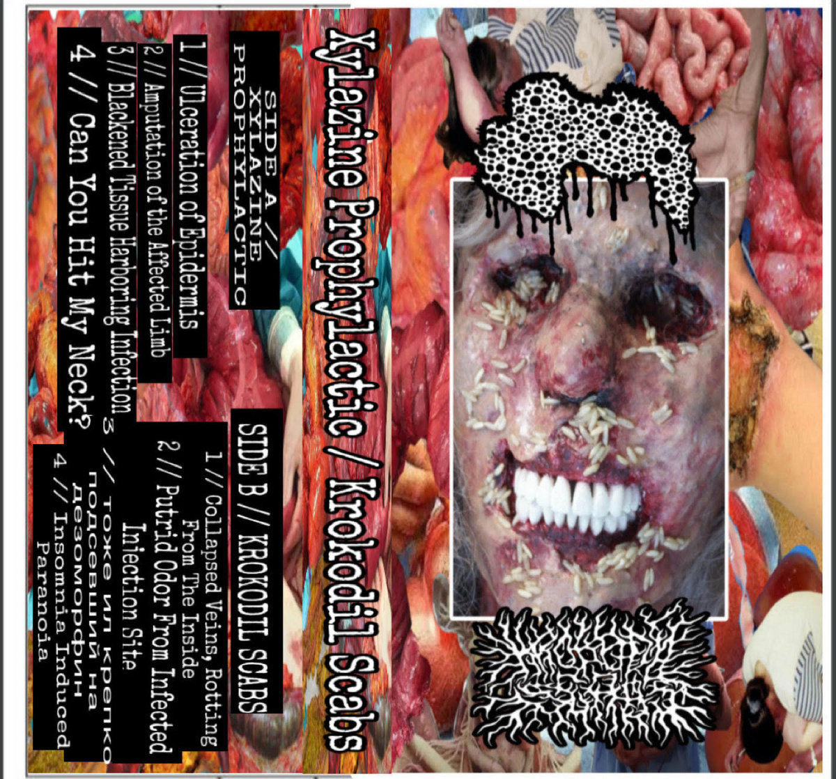 SPLIT W/ XYLAZINE PROPHYLACTIC | Krokodil Scabs