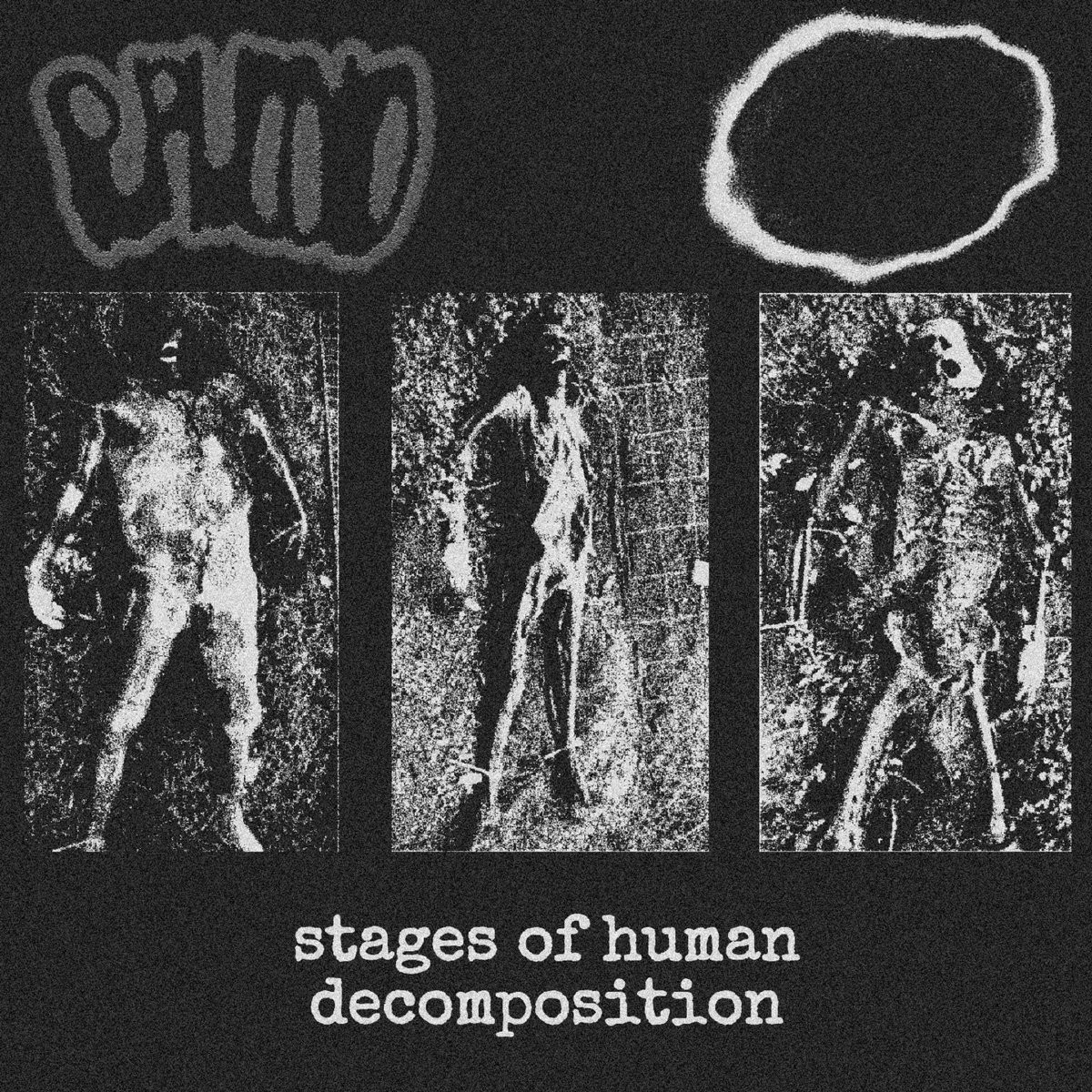 Stages of Human Decomposition | DxBxExSxAxP, Puruloid | Severed Nerve ...