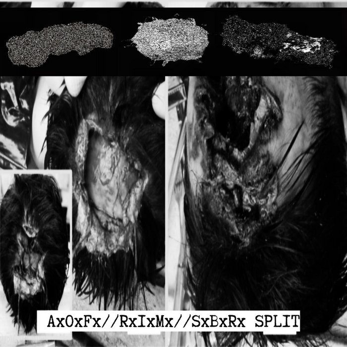 Split W/ Acidiotic Organ Failure & Rabies Induced Mania | Syphilitic ...