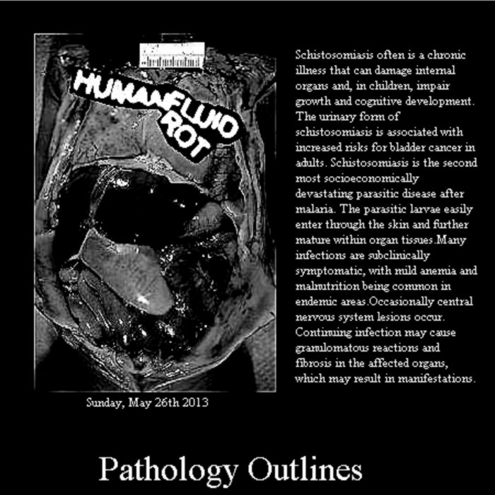 Pathology Outlines | Human Fluid Rot | Florida Noise Ordinance