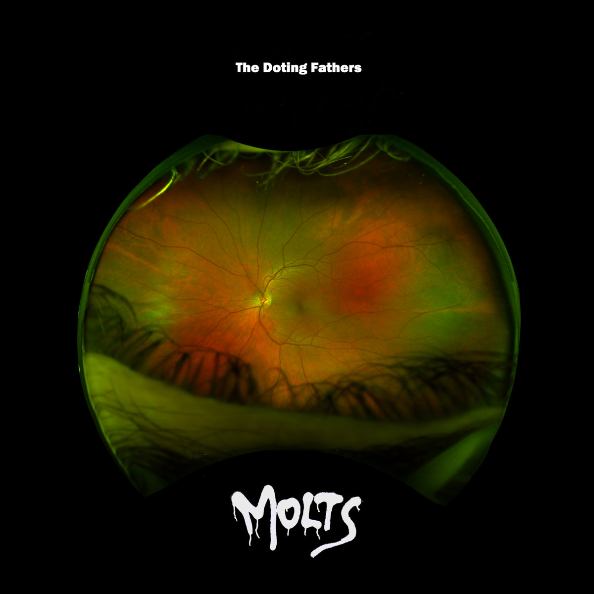 Molts | The Doting Fathers