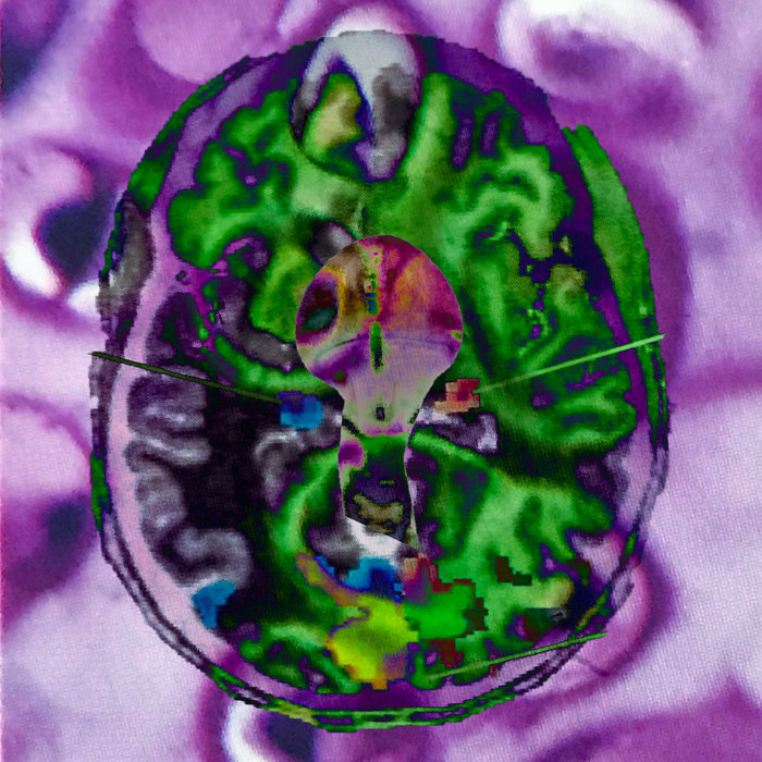 Anderson - Hemisphere Sync Activation EP | Anderson