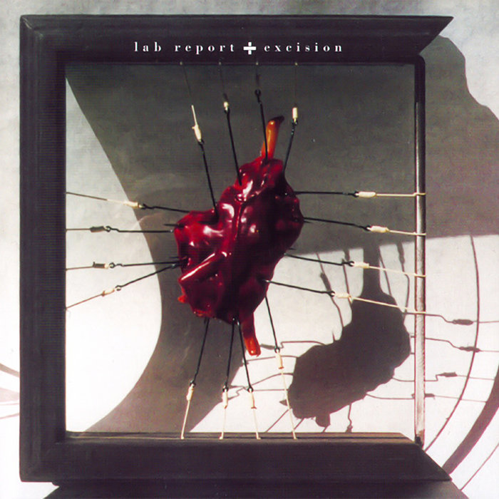 Lab Report ~ Excision | Matt Schultz