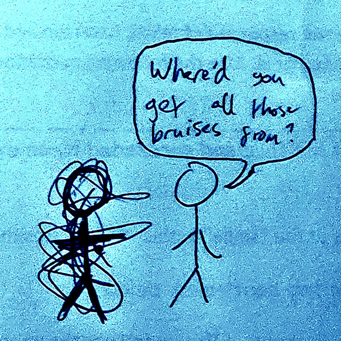 Where'd You Get Those Bruises? [4-track album prep] | Ricky Jamaraz