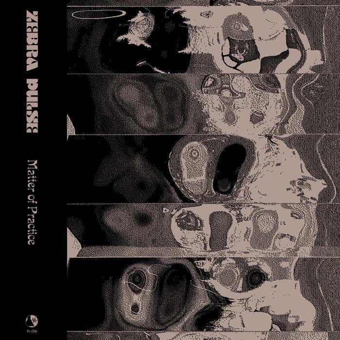 Matter of Practice | Zebra Pulse | Pseudo Laboratories
