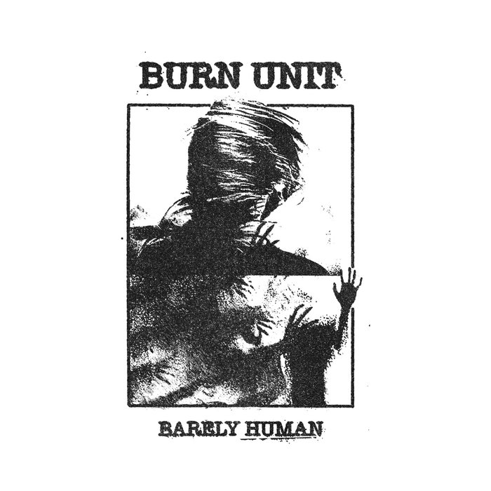 Barely Human | Burn Unit