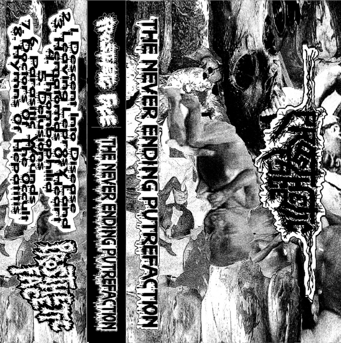 The Never Ending Putrefaction | Prosthetic Face | Severed Nerve Records