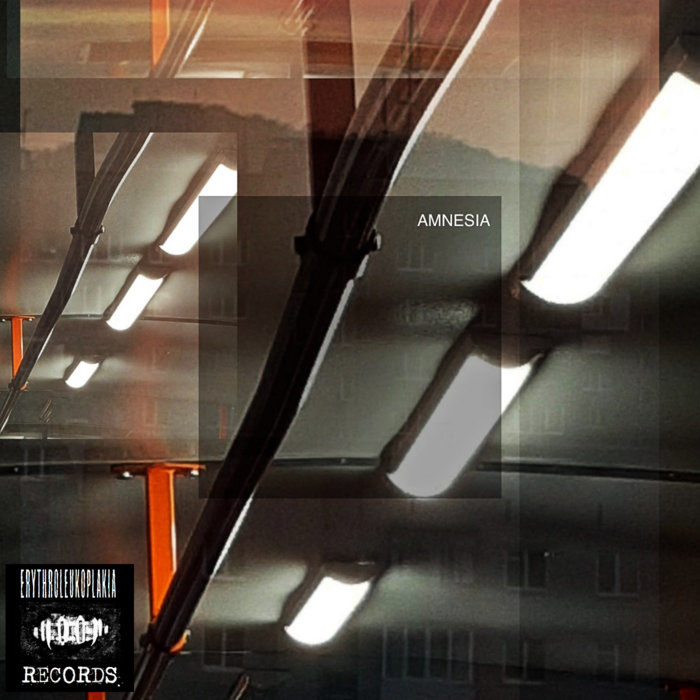 amnesia EP | ne | 𝗘𝗥𝗬𝗧𝗛𝗥𝗢𝗟𝗘𝗨𝗞𝗢𝗣𝗟𝗔𝗞𝗜𝗔 𝗥𝗘𝗖𝗢𝗥𝗗𝗦