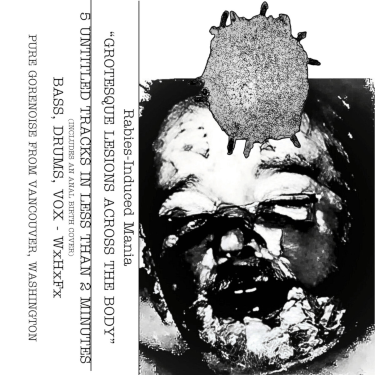 Grotesque Lesions Across the Body | Rabies Induced Mania