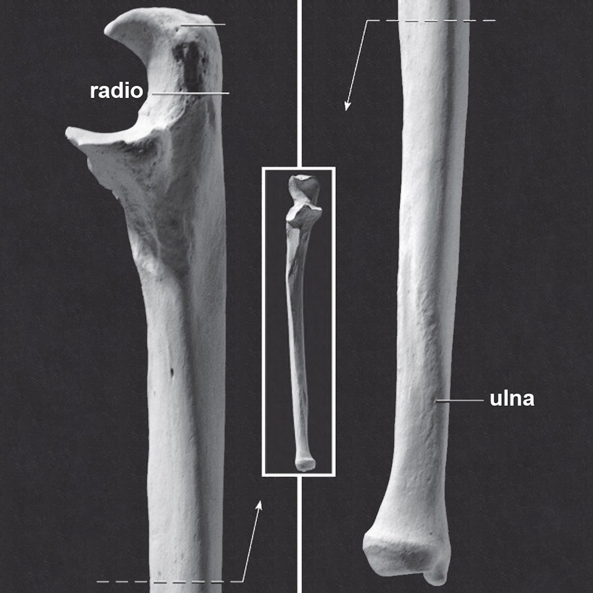 Radio Ulna | Sulk and Bones
