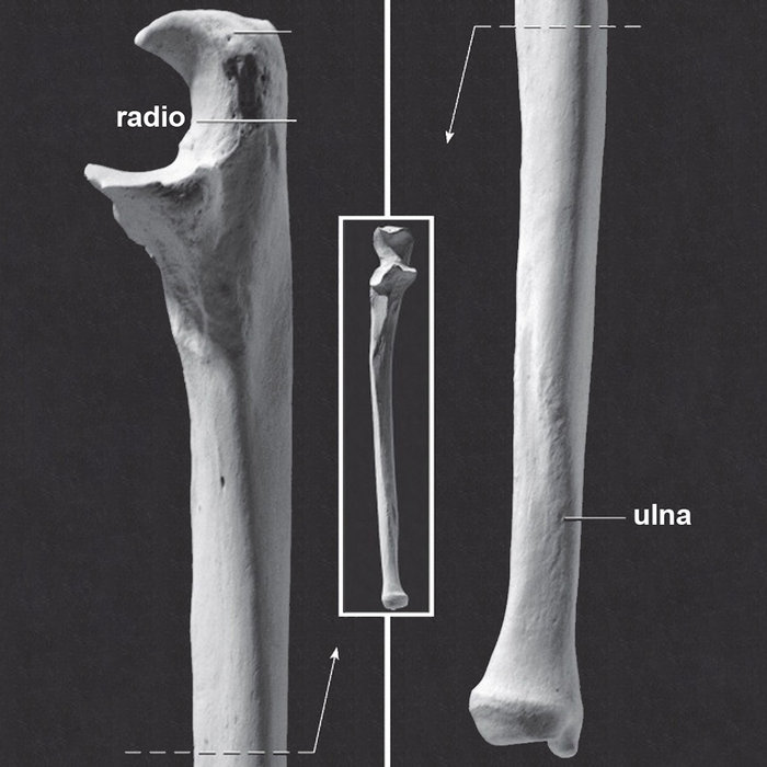 Radio Ulna | Sulk and Bones