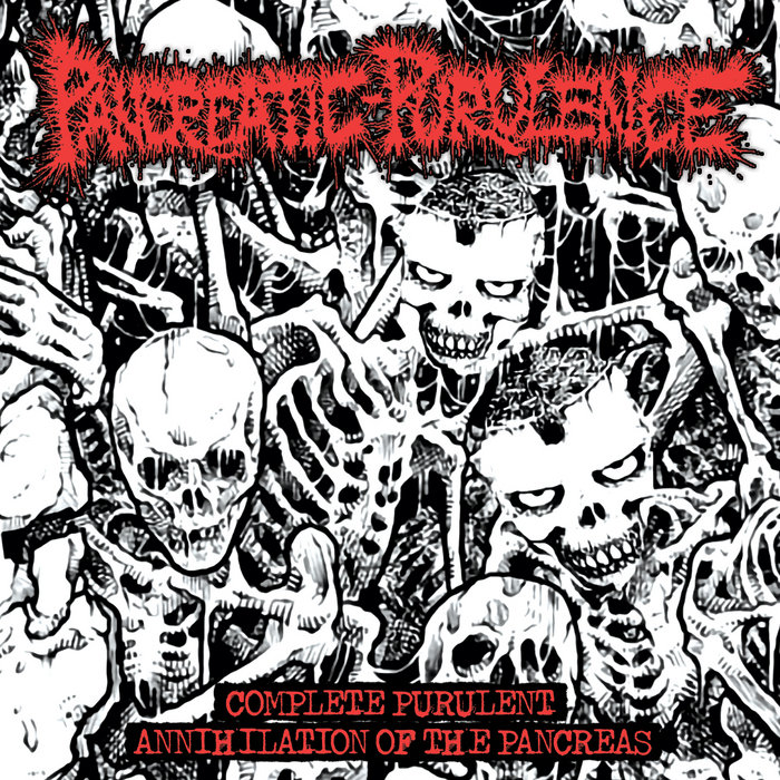 Complete Purulent Annihilation of the Pancreas | Pancreatic Purulence