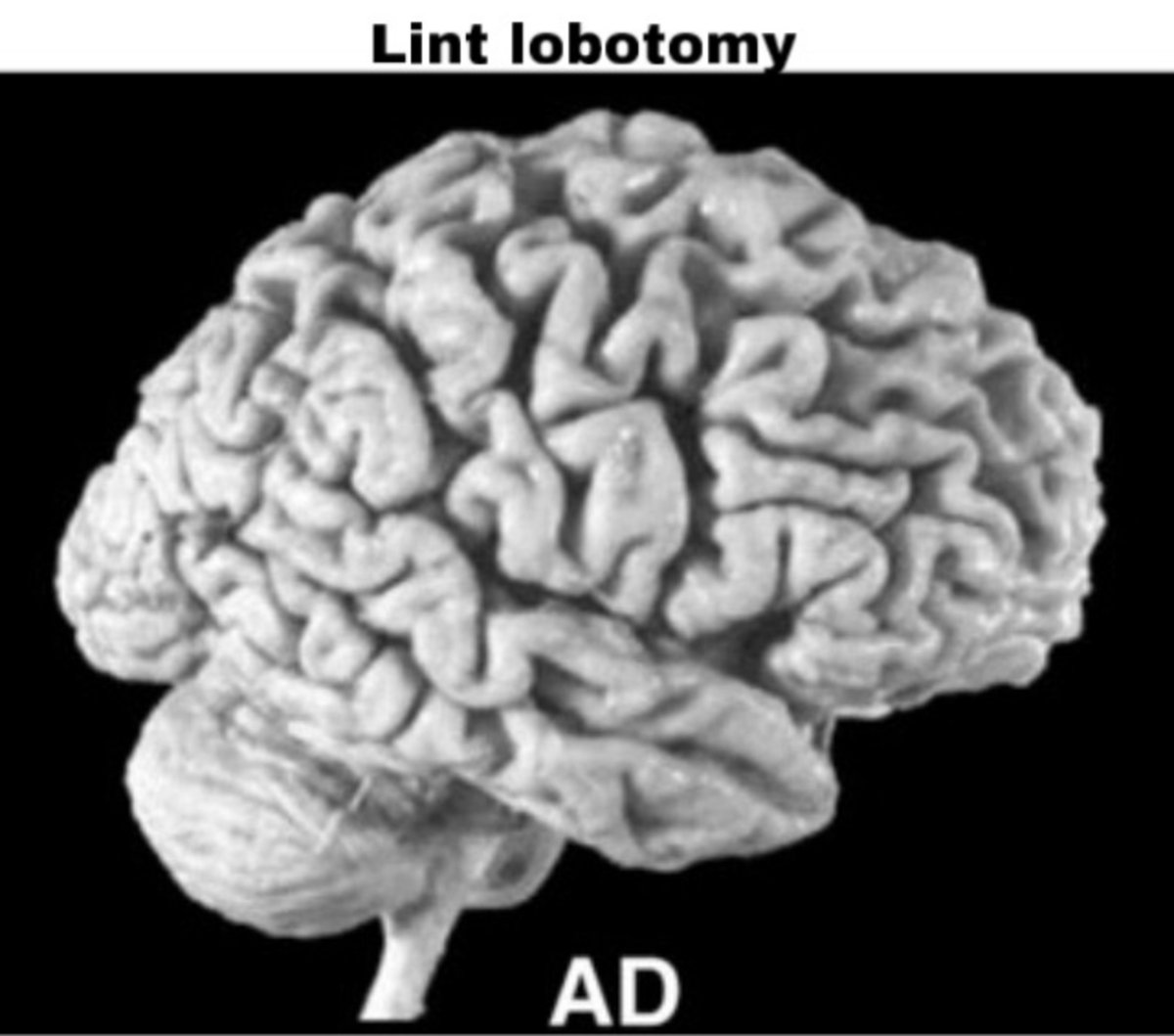 Lint Lobotomy "AD" | C!A