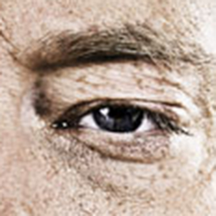 look at the eye again | pictures of thom yorke's lazy eye
