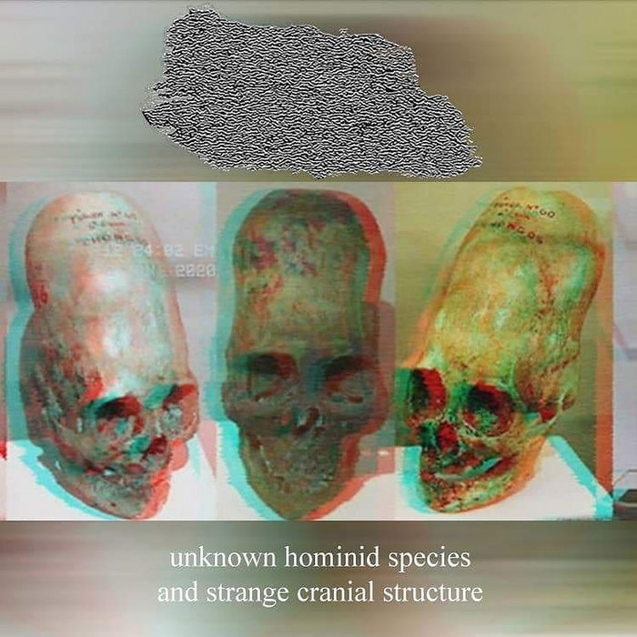 the Paracas skulls - unknown hominid species and strange cranial ...