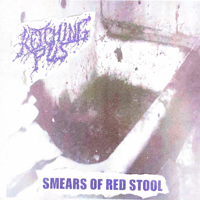 Smears of Red Stool | Retching Pus