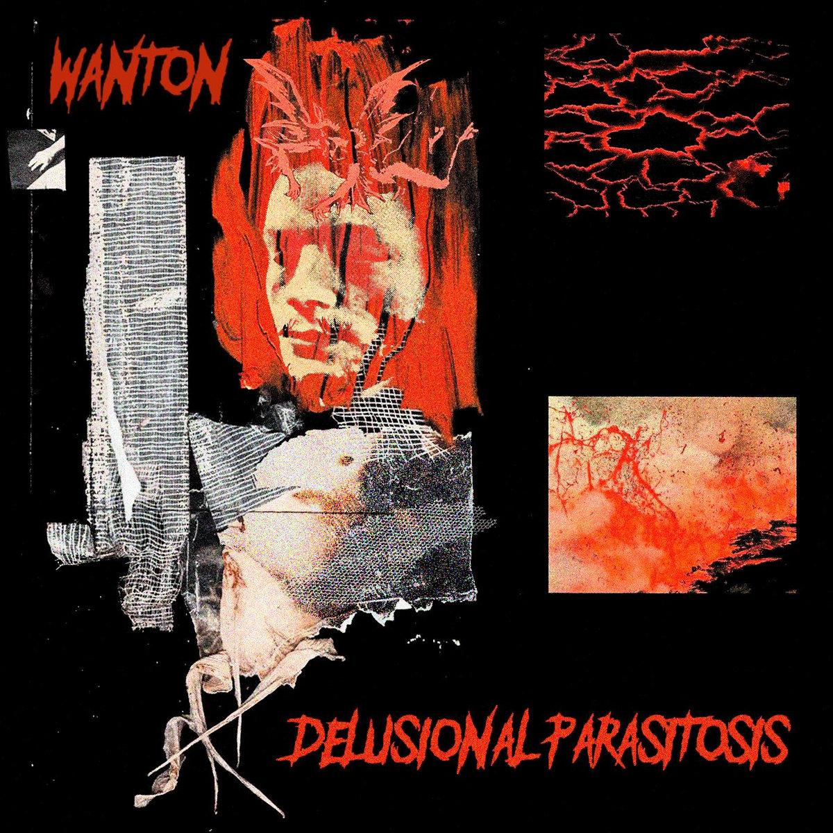 Delusional Parasitosis (Remastered) | Wanton