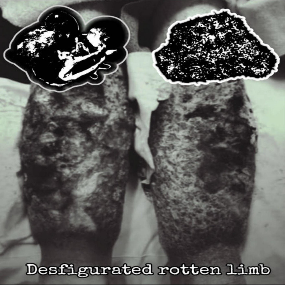 Disfigurated Rotten Limb (split w/ Resto de vomito) | Syphilitic Cranial Hemorrhage