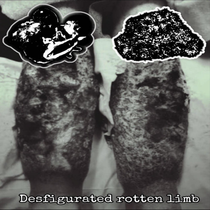 Disfigurated Rotten Limb (split w/ Resto de vomito) | Syphilitic ...