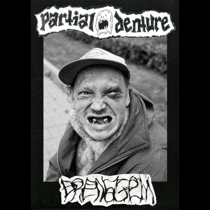 A Clatter That Breaks Your Teeth! | Partial Denture / Drenagem | DRENAGEM