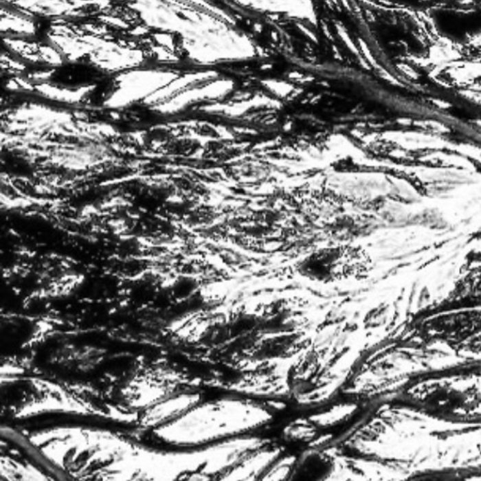 Spider Vein Paralysis | Hearse Case Scenario | Carbon Son