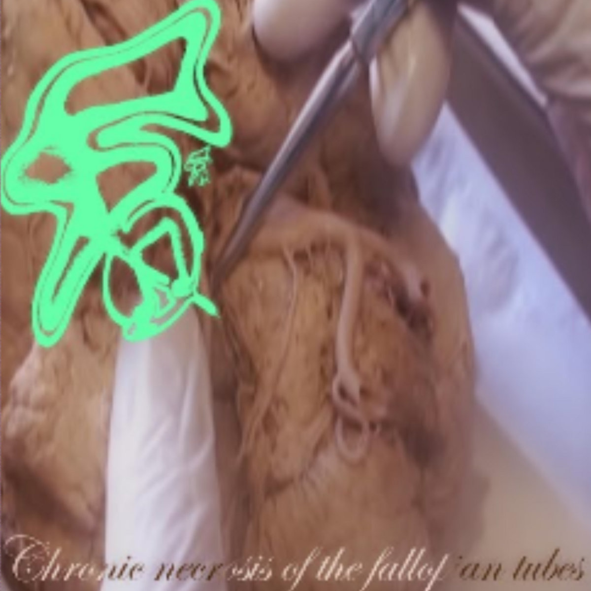 Chronic Necrosis of The Fallopian Tubes | HxOxAx | SnuffAddikt