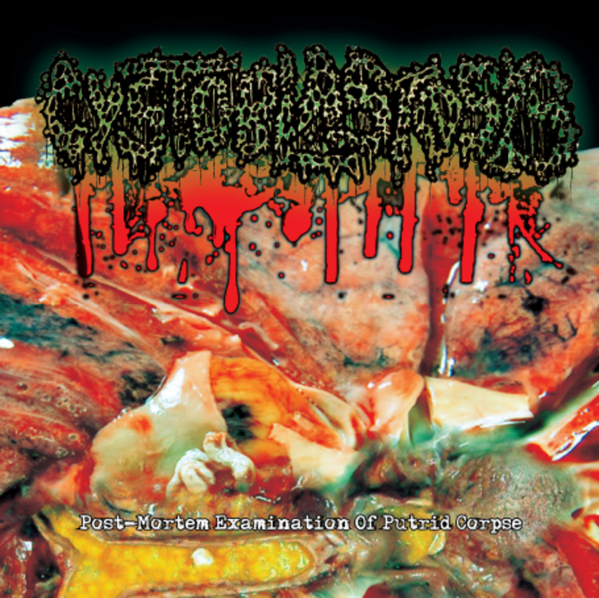 CYSTOBLASTOSIS: Post-Mortem Examination Of Putrid Corpse – Full Album ...