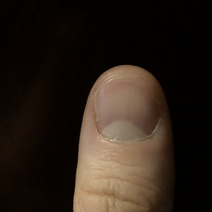 Nail Clippings | Austin Miller | AustinMillerAE