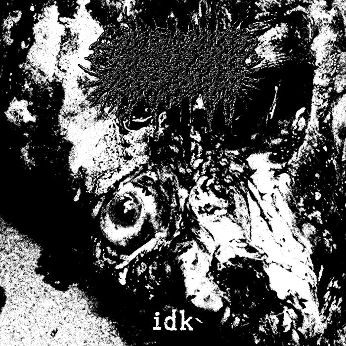 idk | Severe Postpartum Hemorrhage By Uterine Artery Embolization