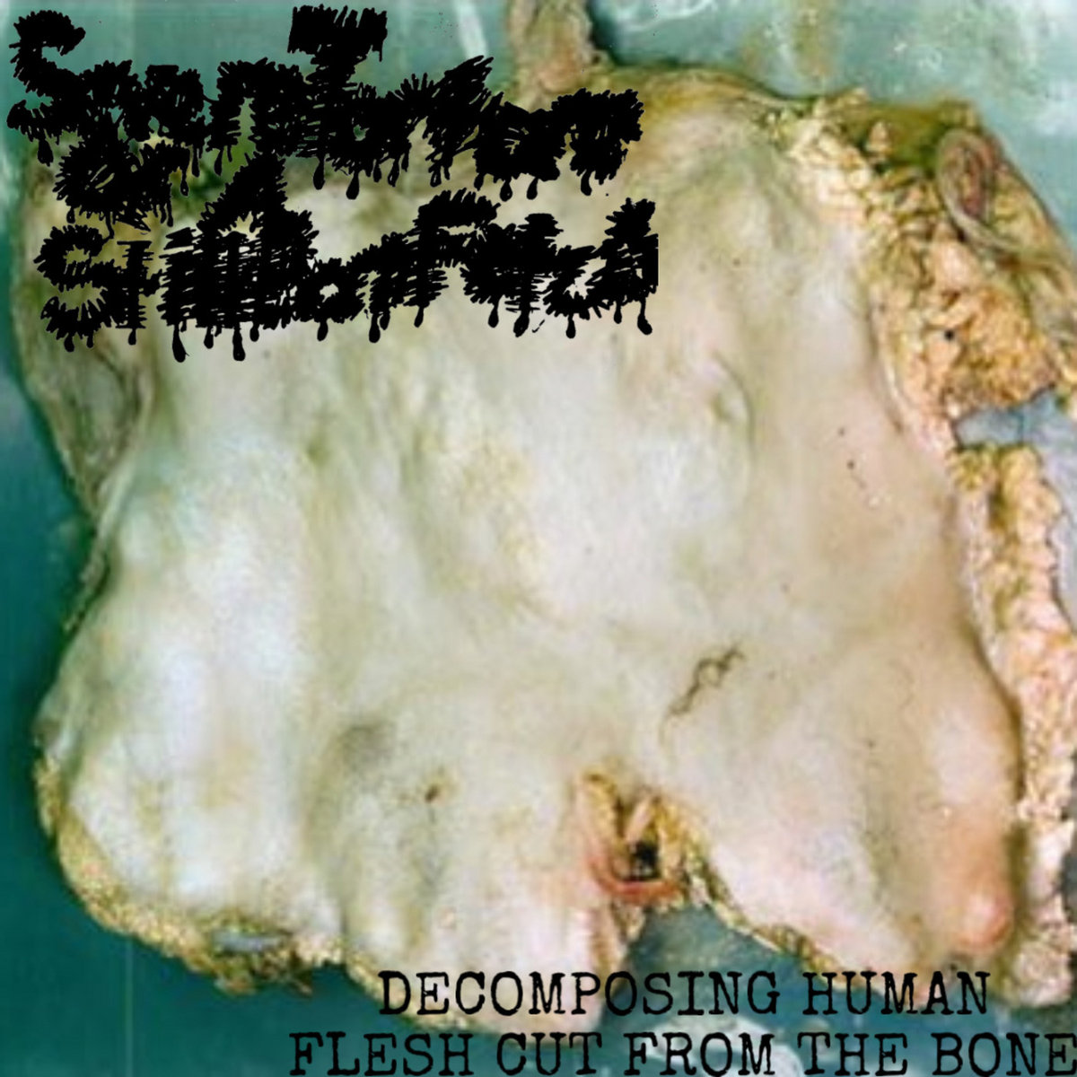 Decomposing Human Meat Cut From The Bone | Severe Torture Of A ...