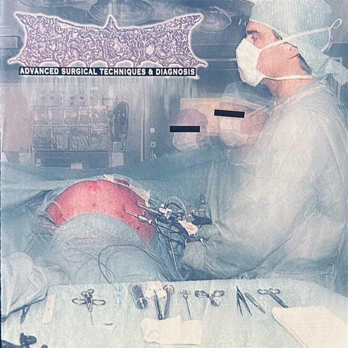 Advanced Surgical Techniques & Diagnosis | Biocyst | Disturbed Mind Records