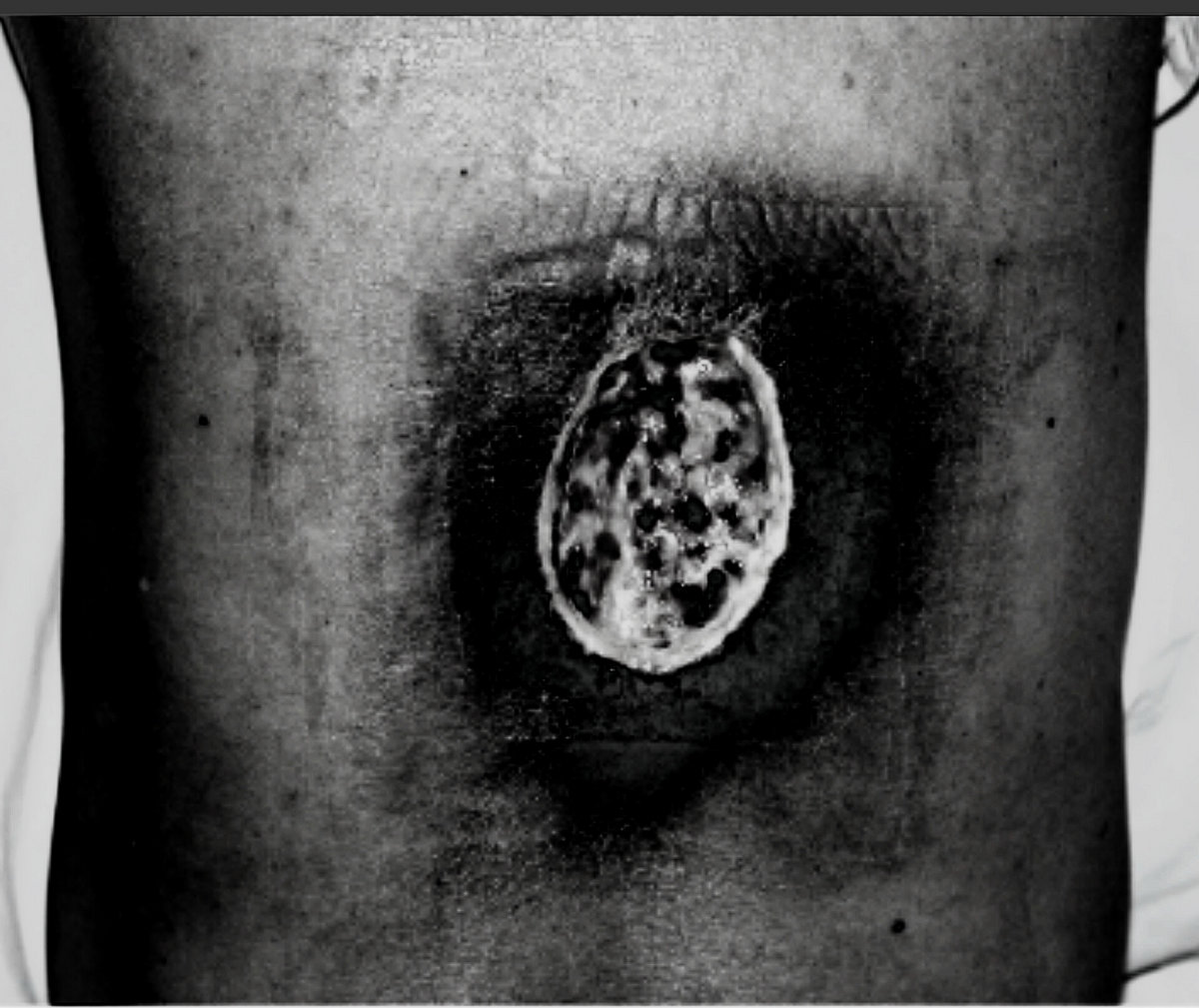 As We Rot From Inside | Errant Static