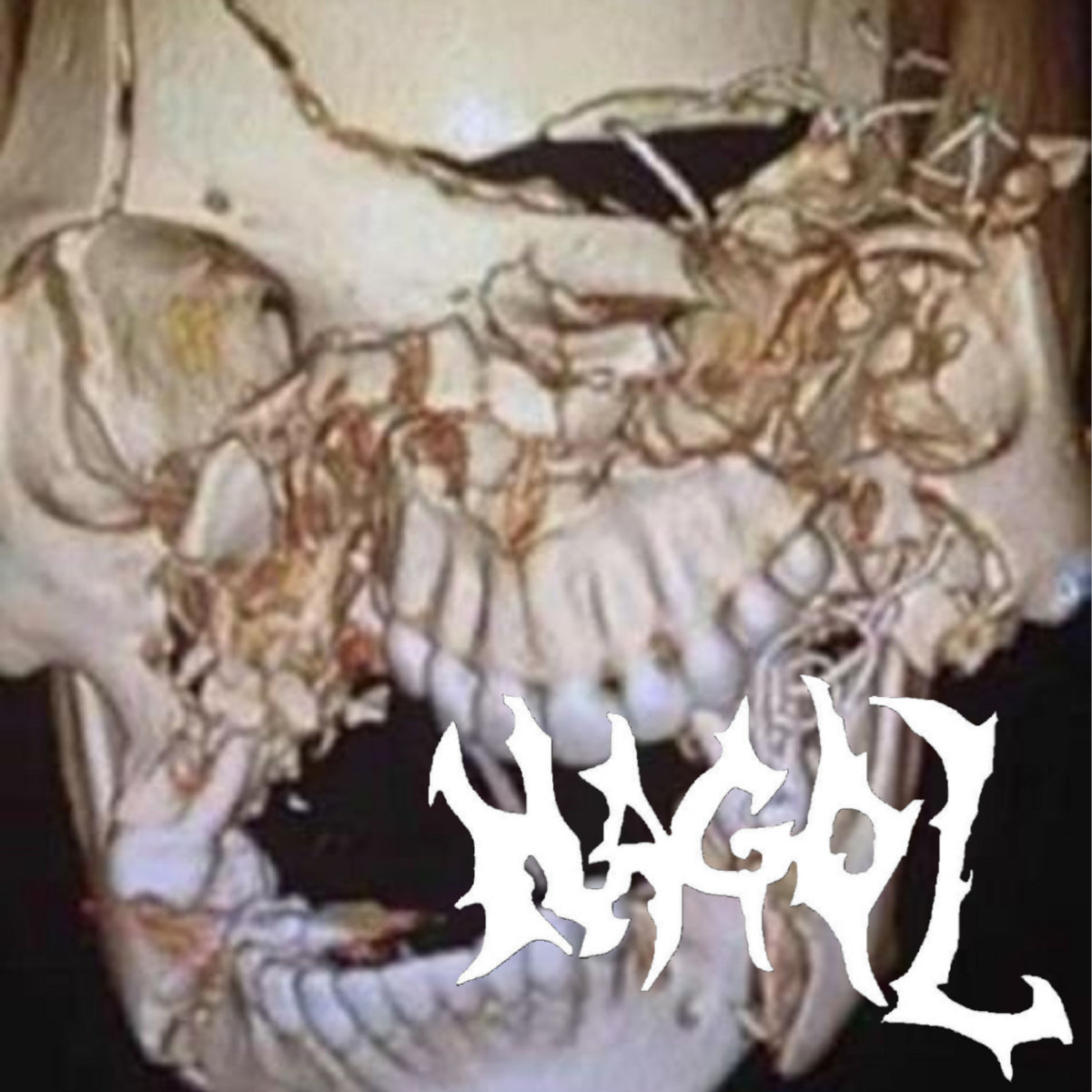 Skull Crushers | NagoL | Bloodshedding Records