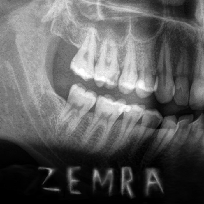 ZEMRA | ZEMRA