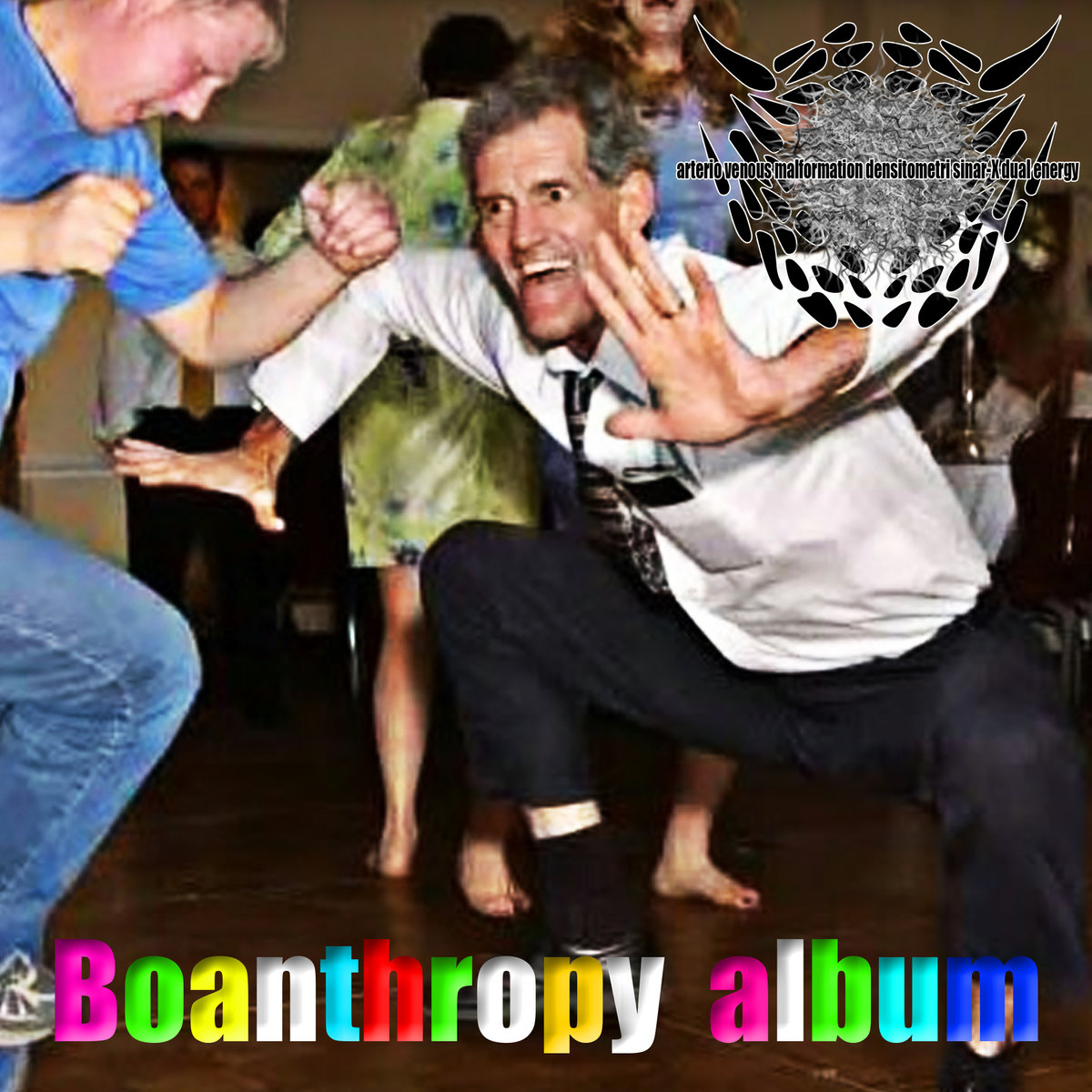 Boanthropy | AxVxMxDxSxXxDxEx | ARTERIO VENOUS MALFORMATION ...