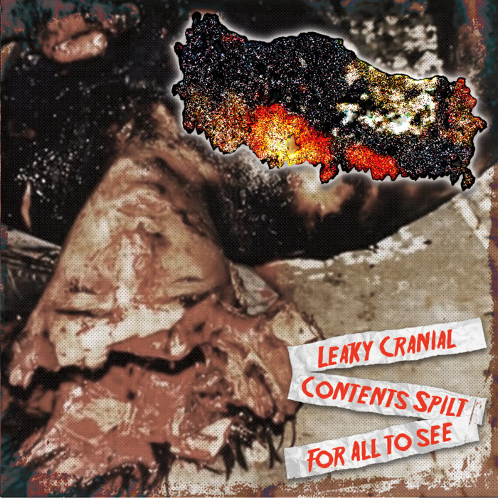 Leaky Cranial Contents Spilt For All To See | Syphilitic Brain Rot