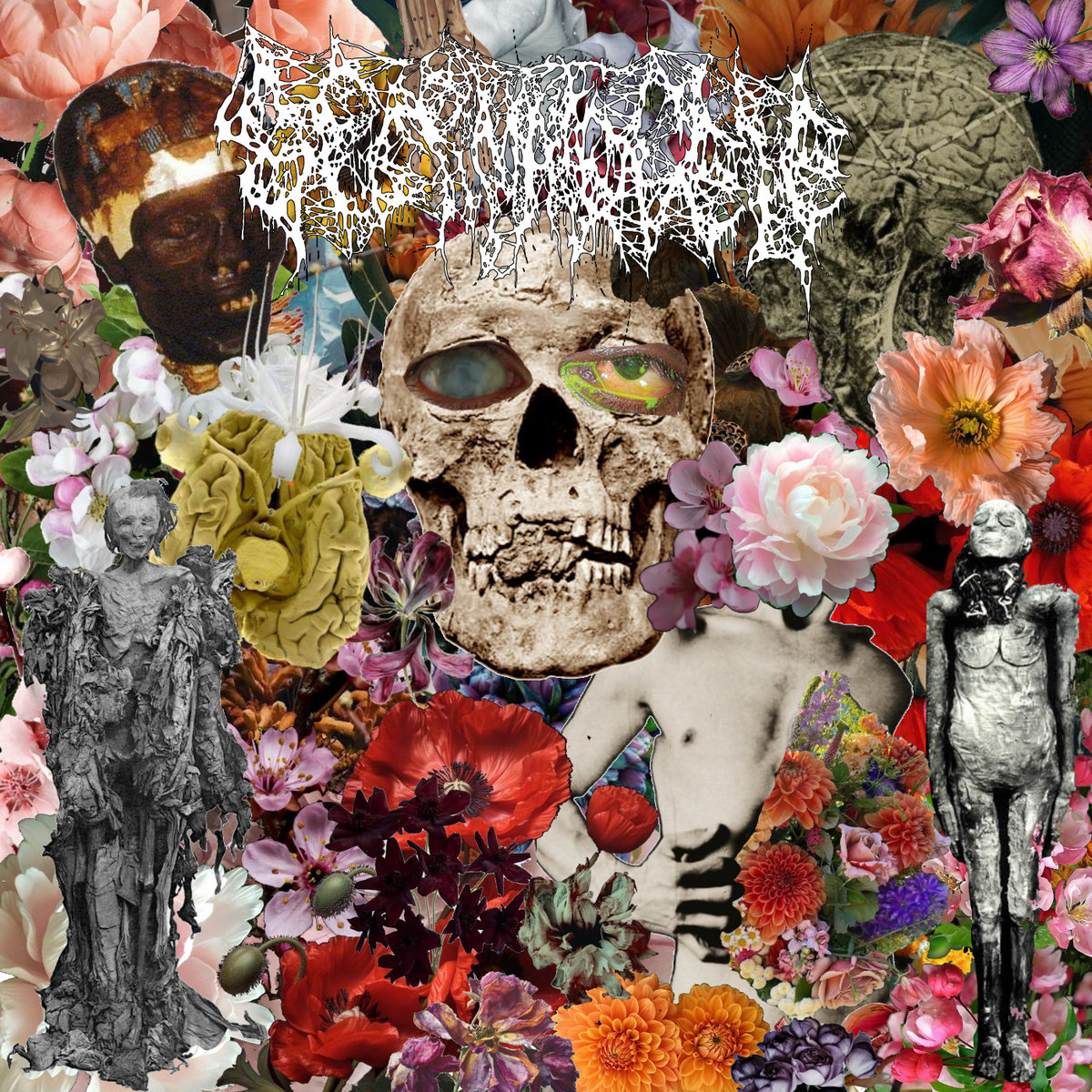Reek of Smegma | Spermatocele