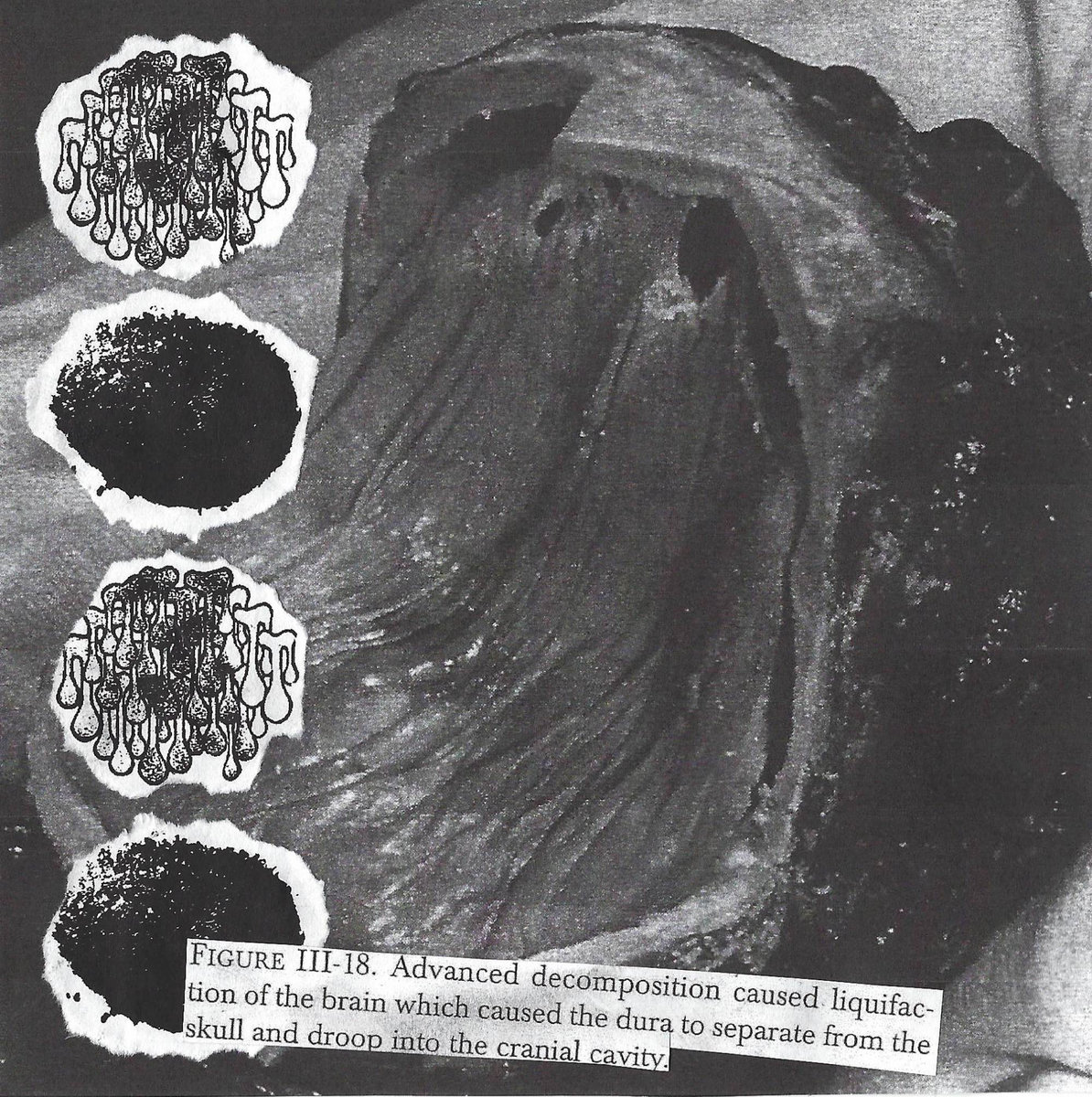 Stercoraceous Copremesis Rhinorrhea- Untitled Traxx | Stercoraceous ...