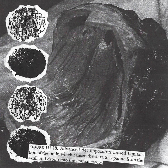 Stercoraceous Copremesis Rhinorrhea- Untitled Traxx | Stercoraceous ...