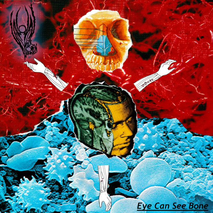 Eye Can See Bone | Wide Open Wound