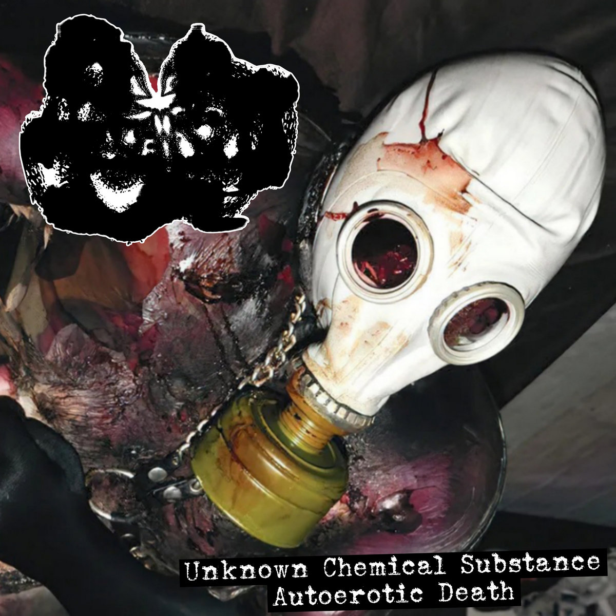 Unknown Chemical Substance Autoerotic Death | Pleomorphic Sarcoma