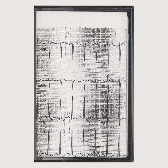 Regaining Composure b/w Negating Freedom | Keith Fullerton Whitman