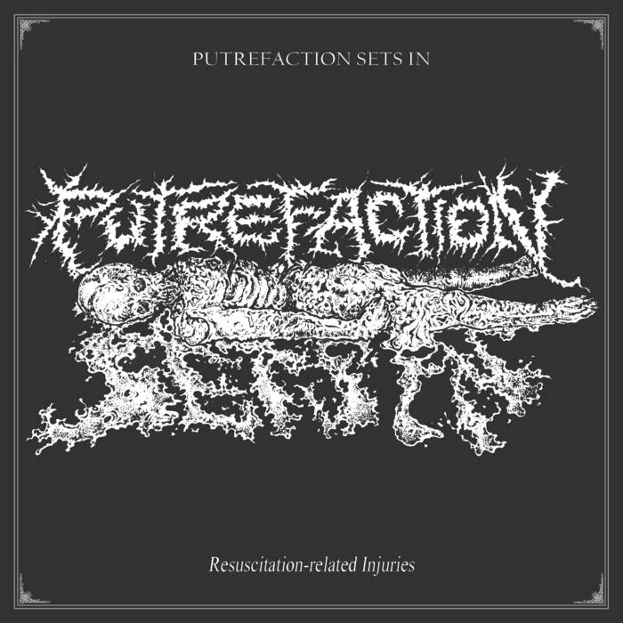 Resuscitation-related Injuries | Putrefaction Sets In