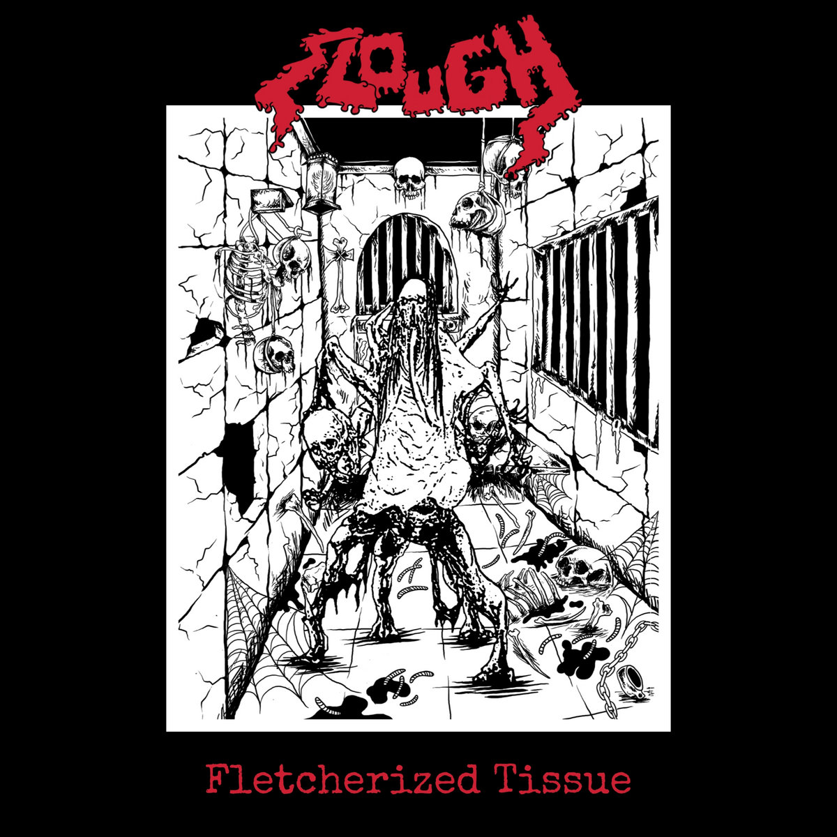 Fletcherized Tissue | Slough