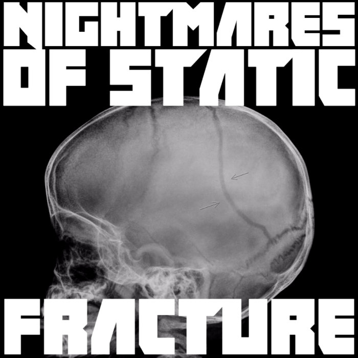Fracture | Nightmares of Static